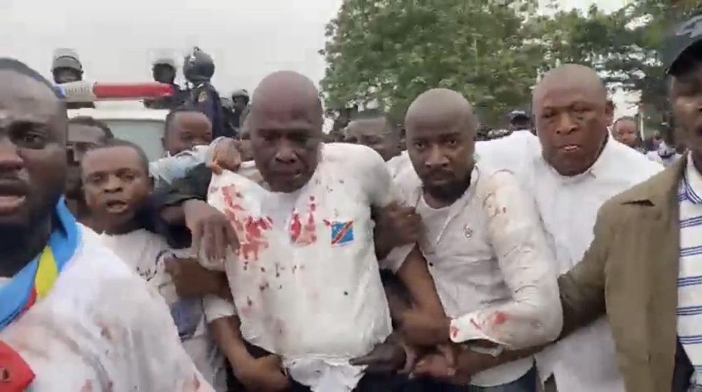 Kinshasa sous tension : Martin Fayulu et Jean-Marc Kabund blessés lors ...